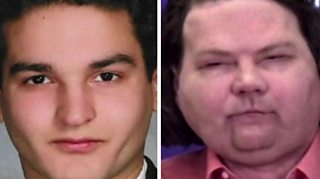 Joe DiMeo: First face and double hand transplant for di world collect ...