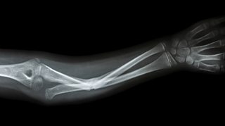 The skeletal system - Skeleton - Living organisms - KS3 Biology - BBC ...