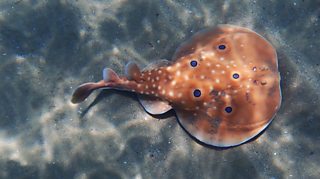 BBC Radio 4 - You're Dead to Me - Six shocking early medical uses of ...