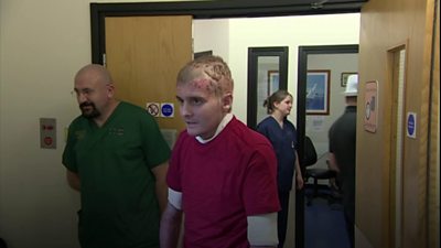 Chippenham gas blast victim Kyle Roe 'lucky to be alive' - BBC News