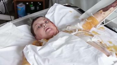 Dead acid victim's defiant message - BBC News