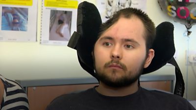 Attack victim: 'I wouldn't wish this on anybody' - BBC News