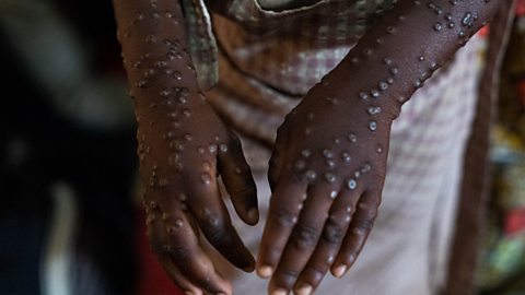 BBC World Service - Newsday