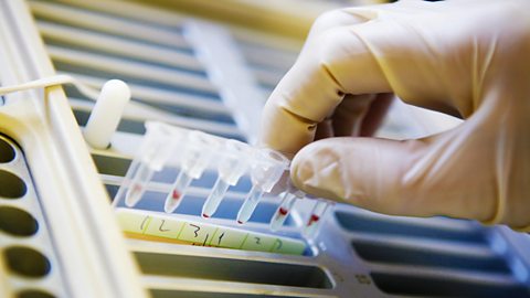 BBC Radio 4 - File on 4, Superbugs