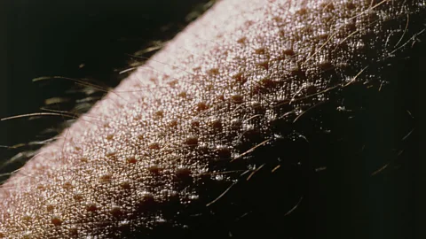 Why do you get goosebumps?