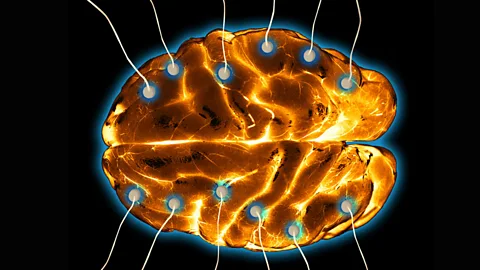 Brain stimulation: The military’s mind-zapping project