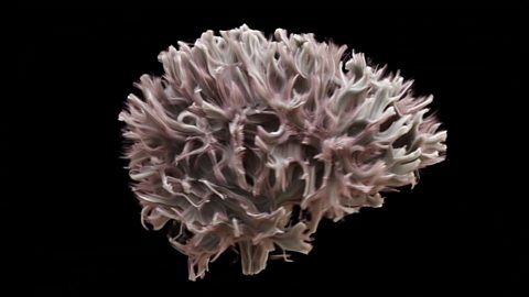 Virus corona: Apa dampak Covid-19 bagi otak manusia? - BBC News Indonesia