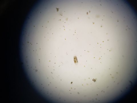 BBC Blogs - Springwatch - Pond Life - how to create a wildlife pond