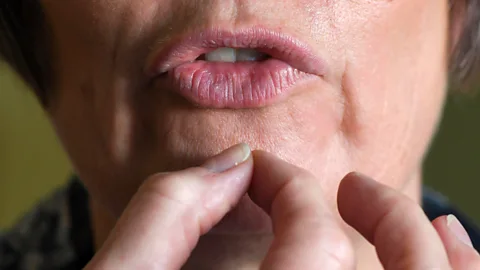 The mysterious cause of stuttering in the brain