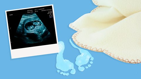 BBC Radio 4 - Woman's Hour - Navigating life after losing a twin ...