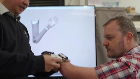 The 'mind-bending' bionic arm powered by AI - BBC News