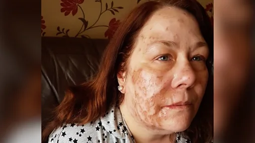 Joanne Rand acid death: Man jailed for 17 years - BBC News