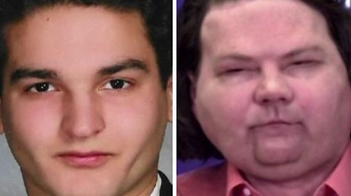 Joe DiMeo: First face and double hand transplant for di world collect ...