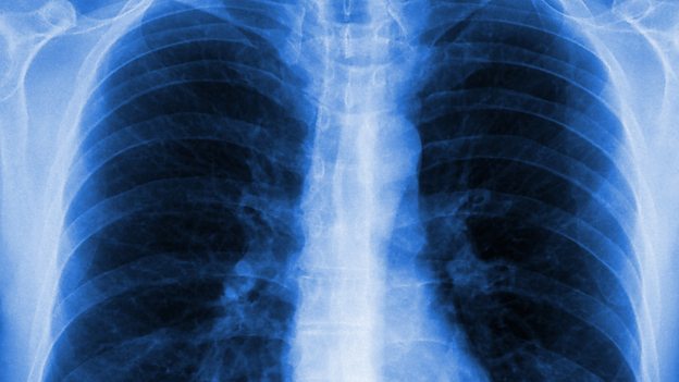 The skeleton - Skeletal and muscular systems - 3rd level Science ...