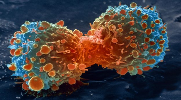 Ionising radiation - Electromagnetic waves and radar - CCEA - GCSE ...