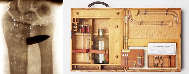 How were injured soldiers treated in World War One? - BBC Bitesize