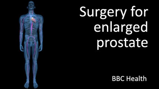 BBC - BBC Health, Surgical procedures: enlarged prostate