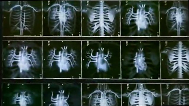 BBC Two - Horizon, 2014-2015, Are Health Tests Really A Good Idea ...