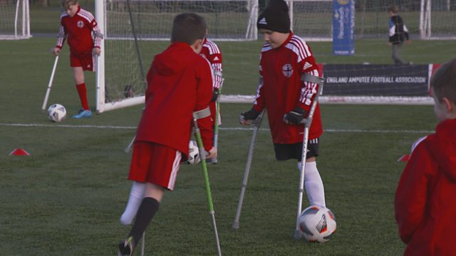 BBC One - The One Show, Amputee Football Association