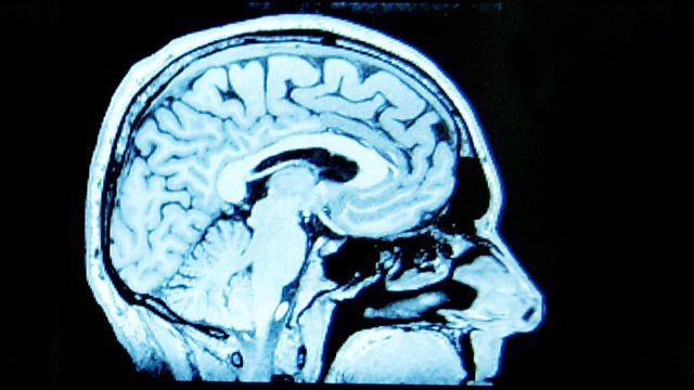 BBC Two - Horizon - The Great British Intelligence Test