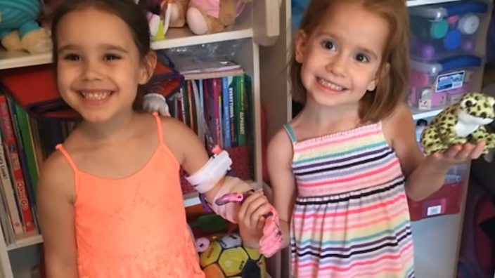 The girl with the 3D-printed arm - BBC Three