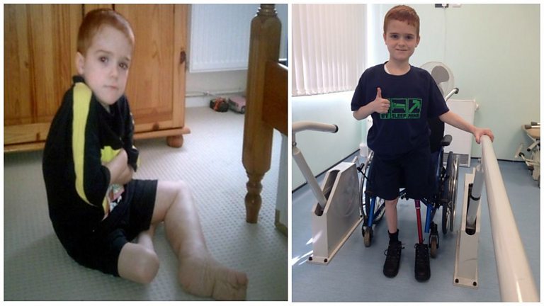 BBC Radio 5 Live - 5 Live In Short, Boy, 11, ‘loving' life after opting ...