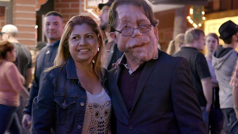 BBC Three - Adam Pearson: Freak Show