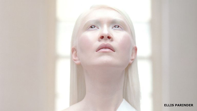 BBC - Living with albinism