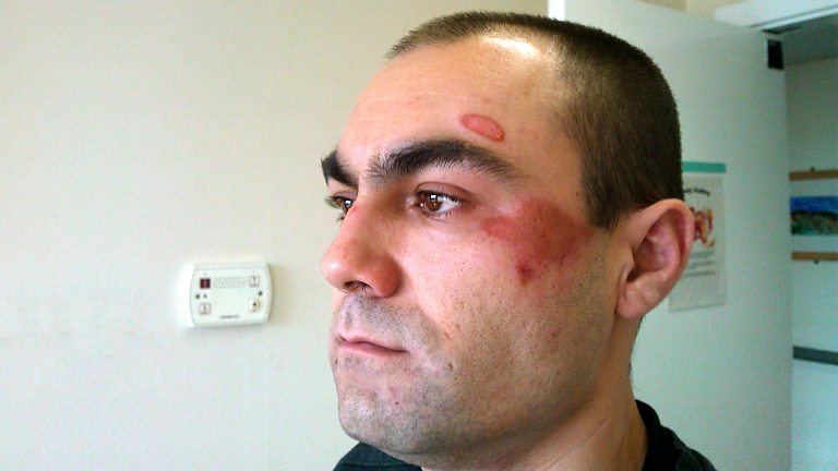 BBC One - BBC Scotland Investigates, 2017, Humans for Sale, Trailer ...