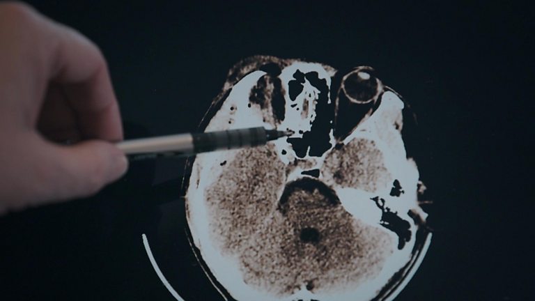 BBC Two - Forensics: The Real CSI