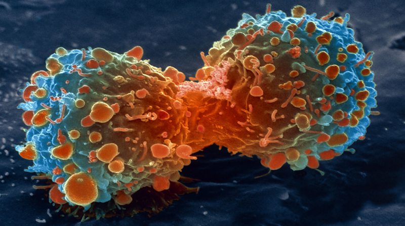 What is cancer? - Radiation and risk - AQA Synergy - GCSE Combined ...