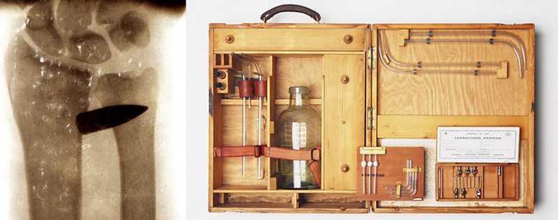 What was medicine like during World War One? - BBC Bitesize