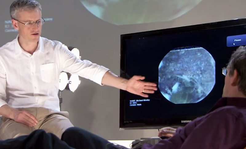 KS2 / KS3 Biology: What a human stomach looks like - BBC Bitesize