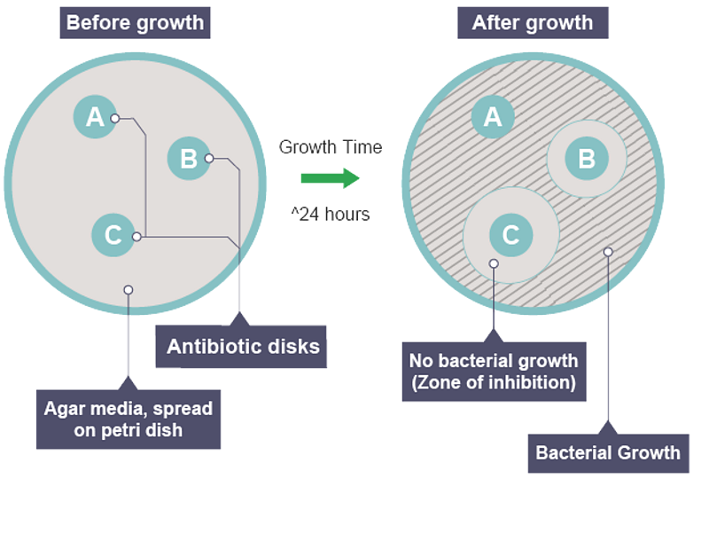 What are the body's defence mechanisms in GCSE Biology? - BBC Bitesize