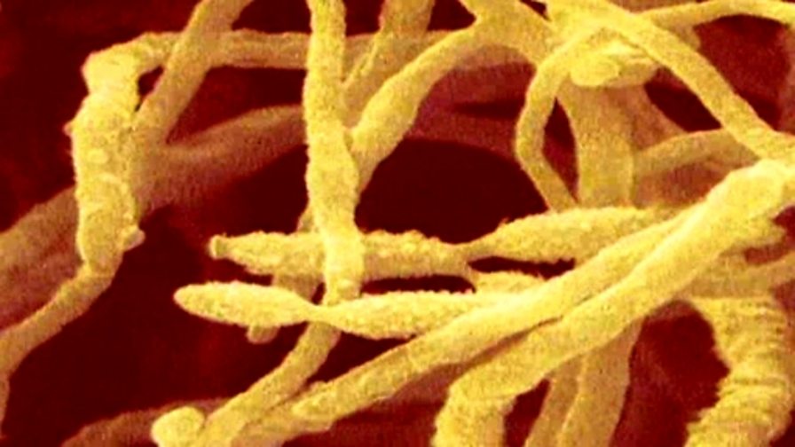 BBC Two - Science Clips, Micro Organisms, What germs can be found on ...