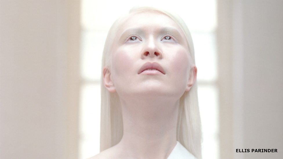 BBC - Living with albinism