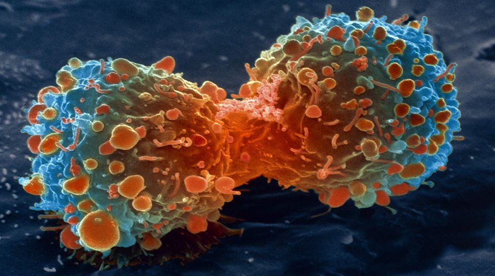 What is cancer? - Radiation and risk - AQA Synergy - GCSE Combined ...