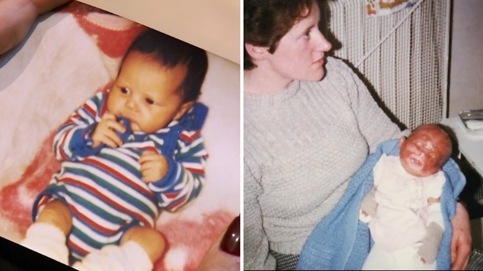 If I get plastic surgery, will it affect my baby? - BBC Three