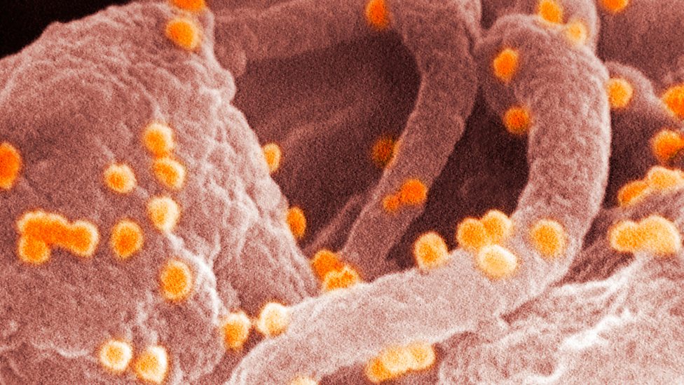 HIV and the immune system - Specific cellular defences against ...