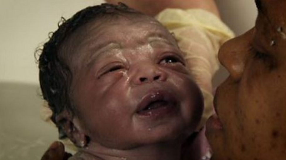 The human eye - BBC Bitesize