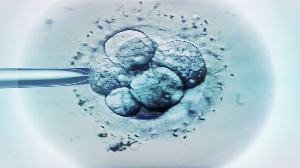 Adult and embryonic stem cells - Living organisms - KS3 Biology - BBC ...