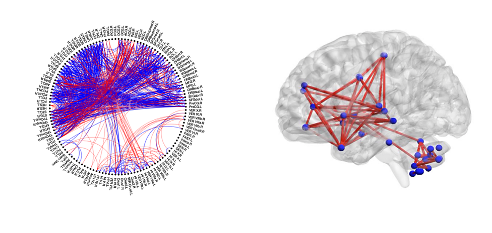 How ultra-processed food may affect your brain - BBC Food