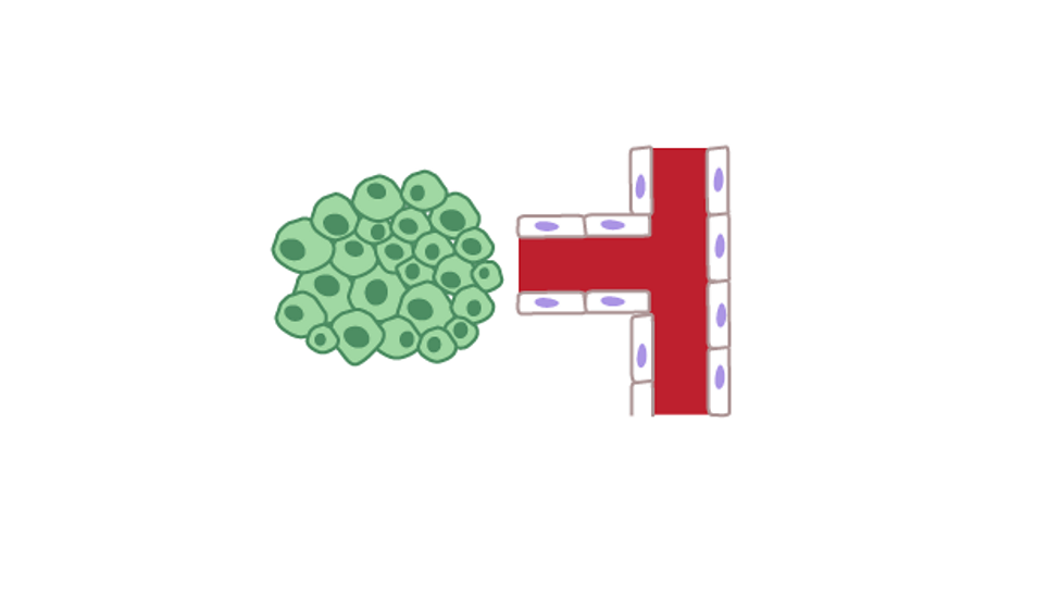 Human illnesses - Health and disease - KS3 Biology - BBC Bitesize