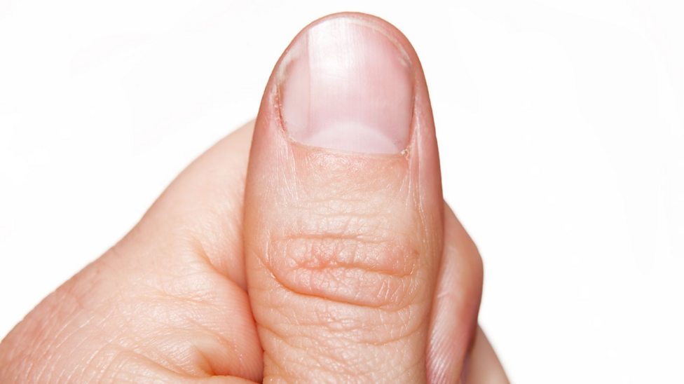 Indeterminate growth: The scientific phenomenon that allows animals and ...