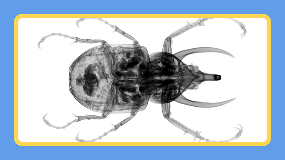 What does your skeleton do? – KS2 Science curriculum - BBC Bitesize