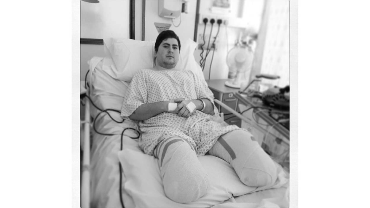 ‘Please cut off my legs’ – life after meningitis - BBC Three