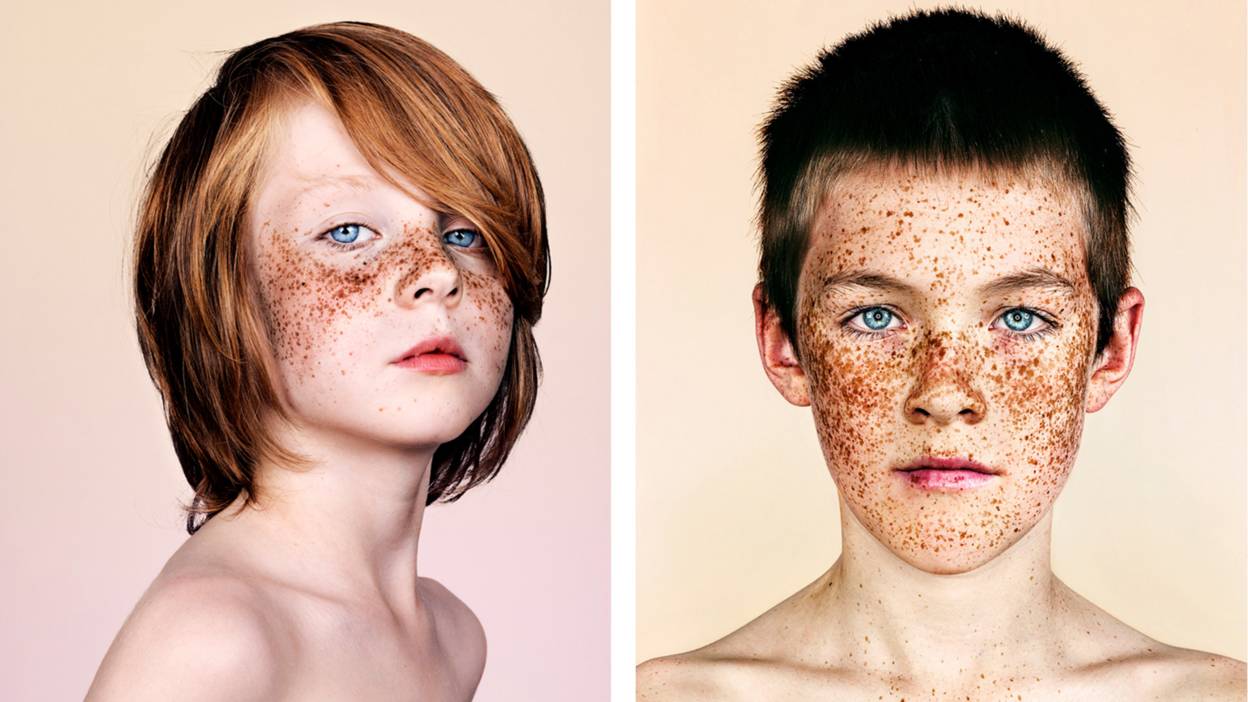 These photos will make you love your freckles - BBC Three