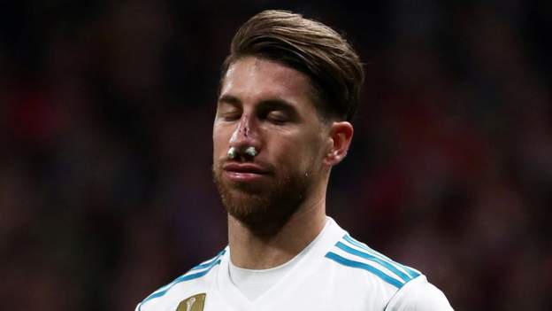 Sergio Ramos: Real Madrid captain broke nose in Atletico derby draw ...