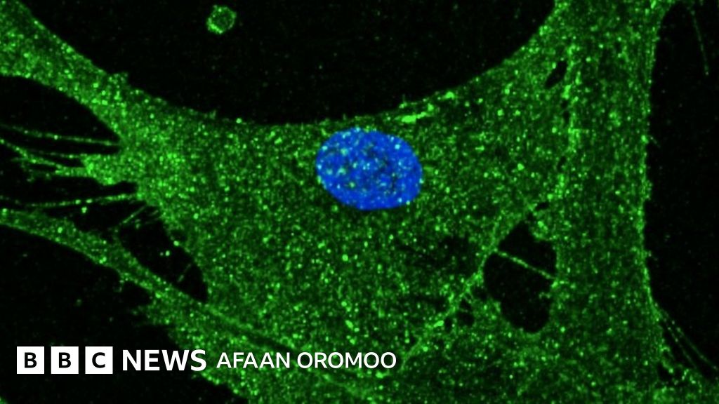 Qorattoonni tekinooloojii gogaa dubartii waggaa 53 kan shamarree waggaa ...