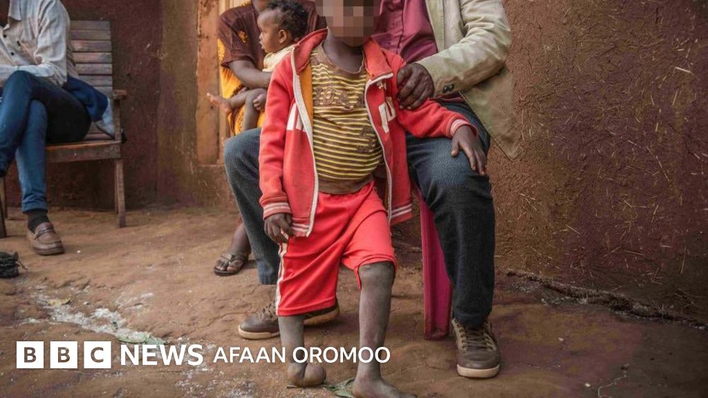 Dhaabbanni oomisha warqee Midroc Laga Dambii akka cufamuuf HRW gaafate ...